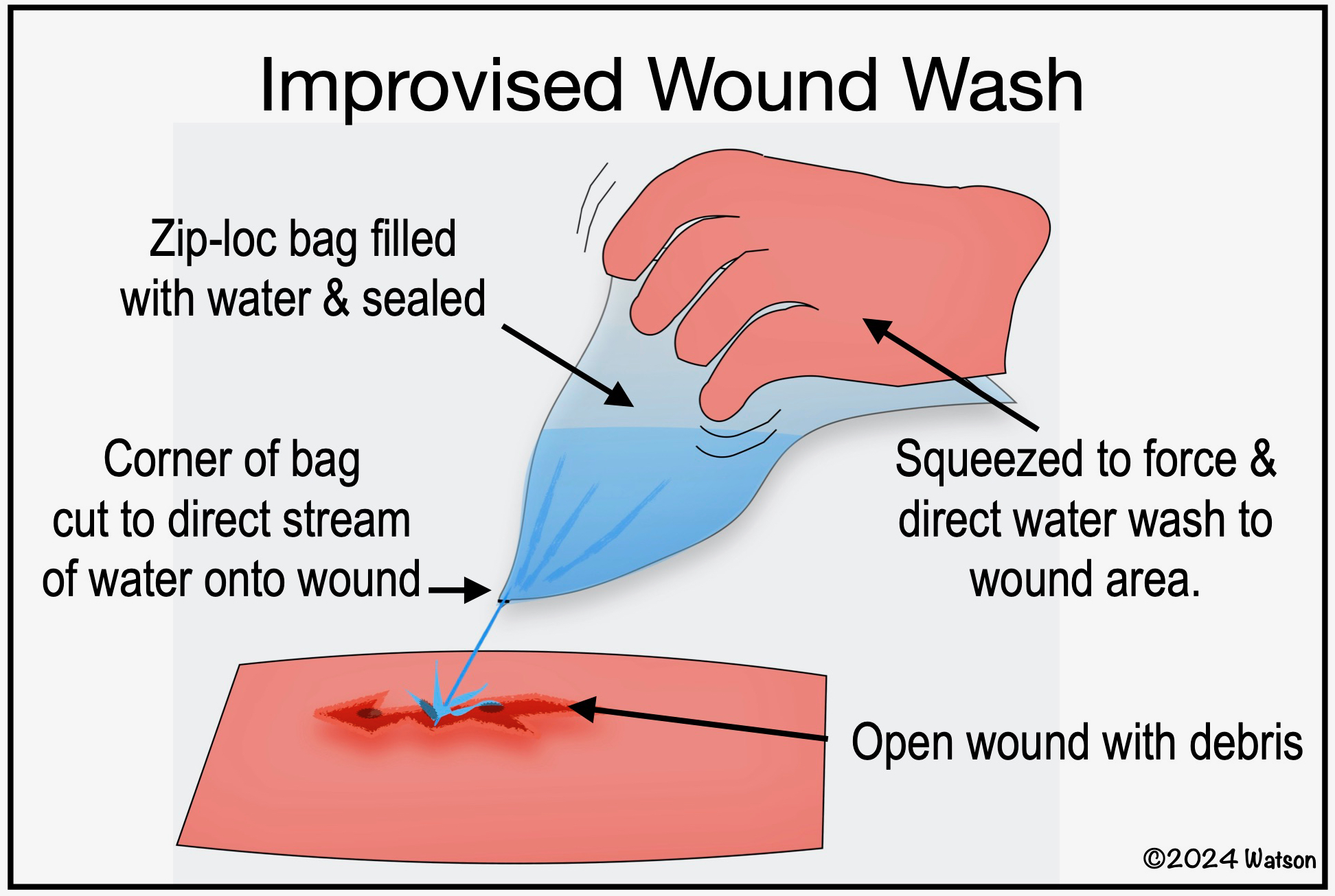 Field First Aid Quick Fixes – TOMOUTDOORS.COM